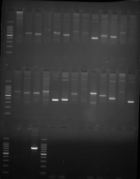 Why I Got Different Bands Sizes For Plasmid Pcr Amplification
