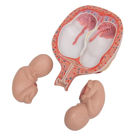 Pregnant Uterus Twins