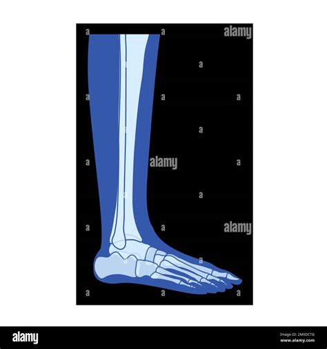 X Ray Foot Legs Skeleton Fibula Tibia Phalanges Human Body Bones