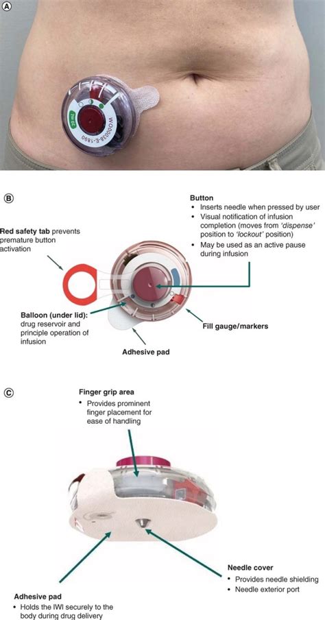 Large Volume Subcutaneous Delivery Enable Injections