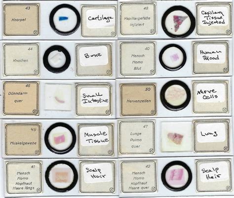 Histology Microscope Slides By Moeller 4782157669