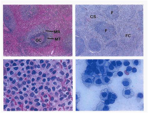 Monocytoid Cell Count Semantic Scholar
