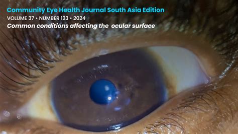 Phfi Cehj Common Conditions Affecting The Ocular Surface