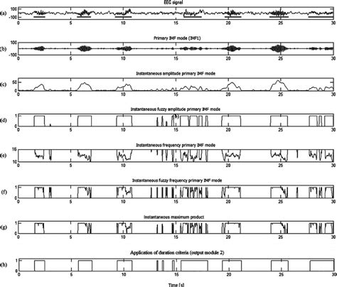 Example Of Module 2 Stages 1 2 And 3 A Eeg Signal Segment With
