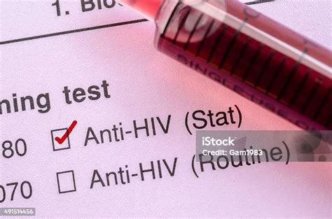 Tanda Centang Merah Yang Benar Dengan Sampel Darah Untuk Tes Hiv Foto Stok Unduh Gambar