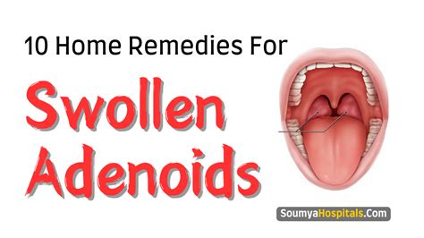 10 Home Remedies To Tackle Swollen Adenoids Naturally