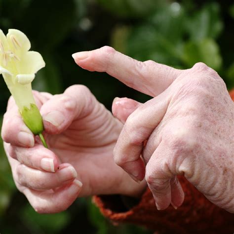 Rheumatoid Arthritis Ra Symptoms Causes Risk Groups Treatment