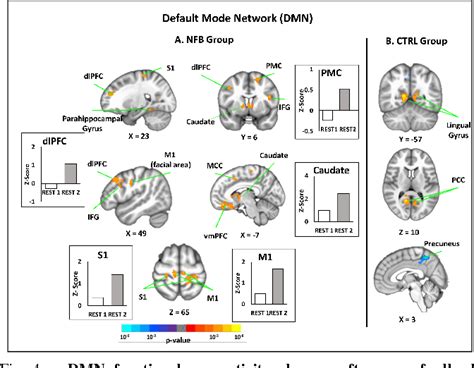 Figure 1 From Self Regulation Of Primary Motor Cortex Activity With Motor Imagery Induces