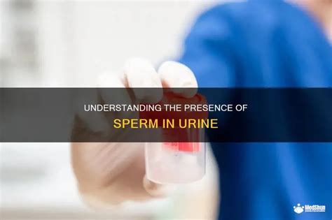 Understanding The Presence Of Sperm In Urine Medshun