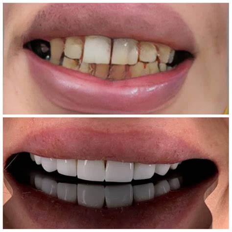 گالری تصاویر دکتر مجید رزمجو کلینیک دندانپزشکی دکتر مجید رزمجو