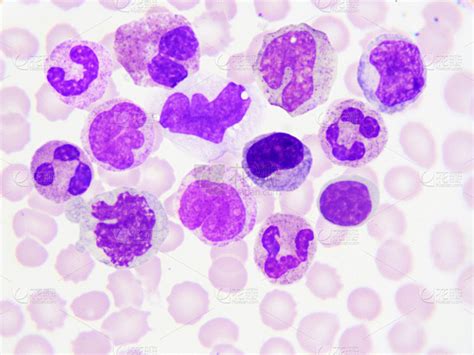 血液涂片中的白细胞