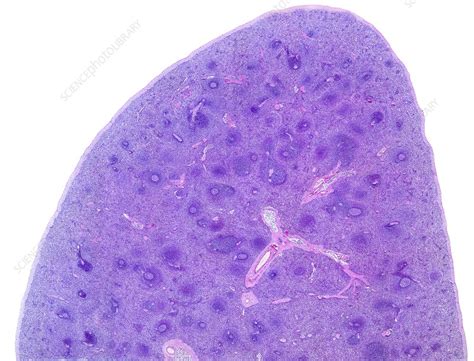 Human Spleen Light Micrograph Stock Image C048 7283 Science Photo Library
