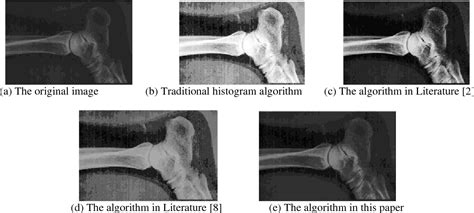 Figure 1 From A Histogram Equalization Algorithm About Second Generation Wavelet Integer