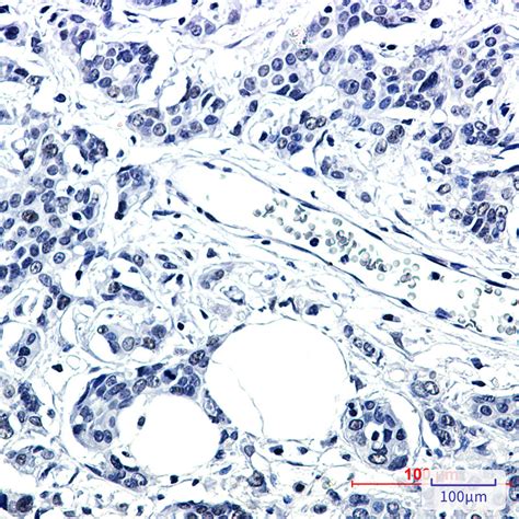 PNKP Rabbit MAb WB IHC P IP Buy Now PNKP Rabbit MAb WB IHC P IP Buy Now