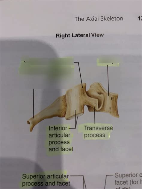 Exercise 9 Axial Skeleton Diagram Quizlet