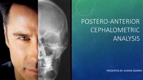 Steiner Analysis In Orthodontics Nay Aung Phdpdf