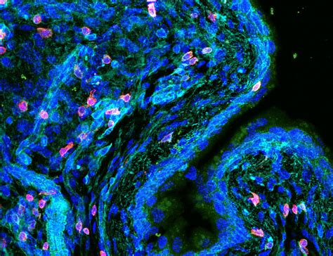 Tissue Resident Memory T Cells Mediate Mucosal Immunity To Recurrent