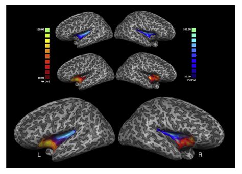 Figure 1 From Functional Connectivity Of The Insula In The Resting Brain Semantic Scholar