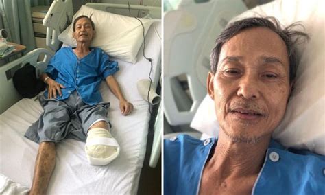 Duan Weiming Discharged From Hospital After Leg Amputation Even If I Die I Will Die In My Own