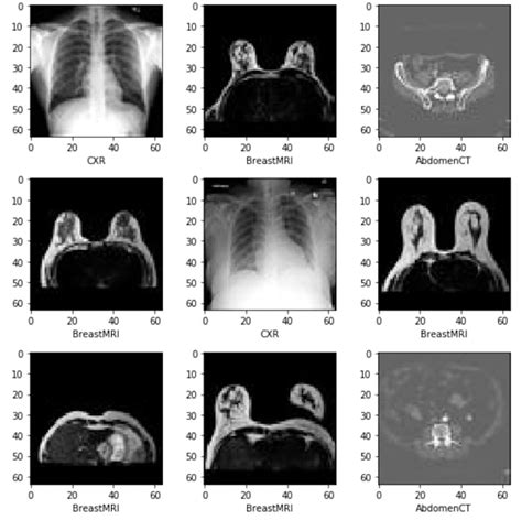 Do Object Detection Recognition And Image Classification By