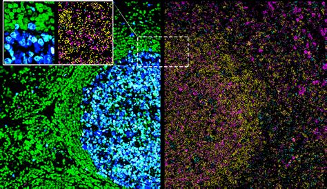Behind The Development Of The High Plex Spatial Molecular Imager From
