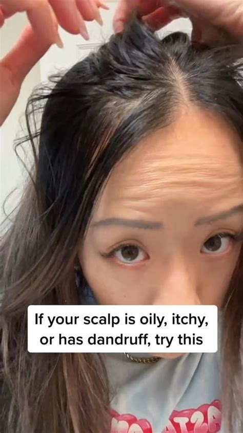 Easy Scalp Exfoliation Hair Care Natural Hair Care Hair Growing Tips