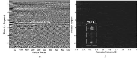 Figure 1 From Improved Human Respiration Detection Method Via Ultra