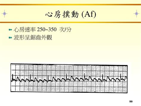 PPT 心電圖原理及常見心電疾病簡介 PowerPoint Presentation ID 3329745