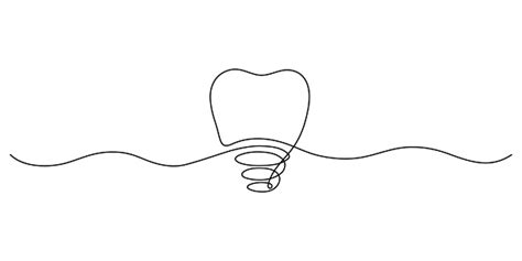 임플란트 치아 연속 아트 라인 그리기 치아의 치과 건강 한 손으로 그린 윤곽선 스타일 벡터 라인아트에 대한 스톡 벡터 아트 및