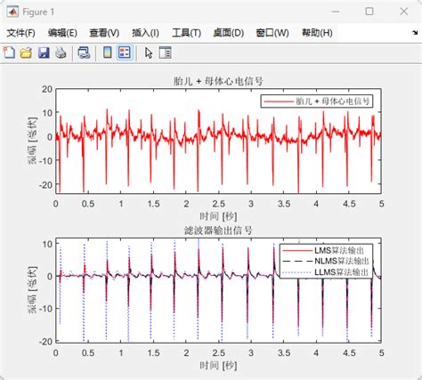 基于matlab自适应滤波算法的胎儿心电信号提取与分析：单输入单输出与多输入单输出系统的对比研究 csdn博客
