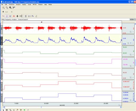 emg electromyography automated emg analysis research biopac