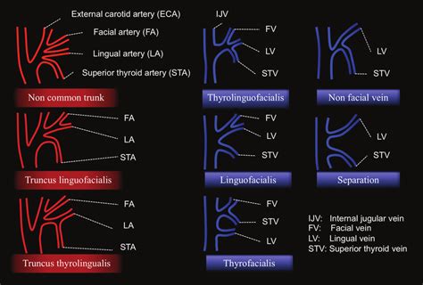 Major Variations In Branching Patterns Of The External Carotid Artery