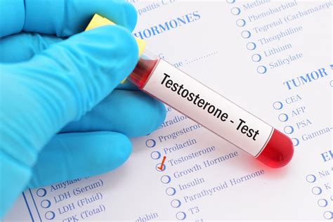 At What Age Do Testosterone Levels Drop Off Most Male Ultracore Blog