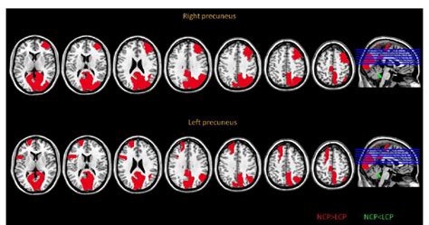 Significant Differences In Correlation In The Two Cognitive Performance