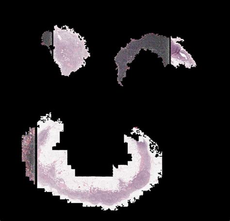 Problem Of Segmentation On Camelyon17 · Issue 51 · Mahmoodlabclam