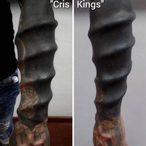 25 Subdermal Implants That Will Make Your Skin Crawl Body Mods Body
