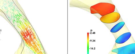 2010 Ieee Transactions On Biomedical Engineering 57 10 2535 48 Lucey Obel