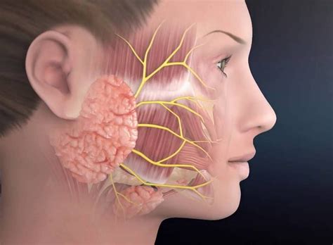 Parotidectomy In Iran With Dr Saeedi Best Expertise And Cost