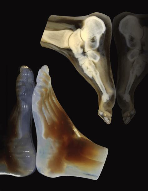 Pdf From Improved Diagnostics To Presurgical Planning High
