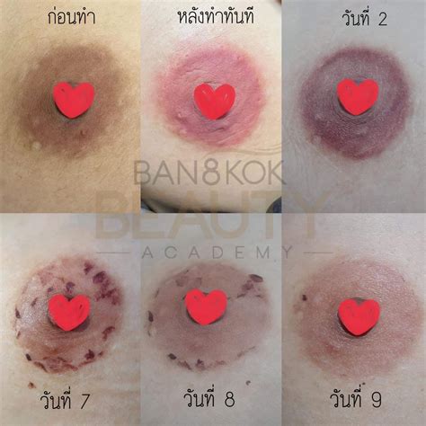 Areola Bangkok Beauty Academy No Microblading In Thailand