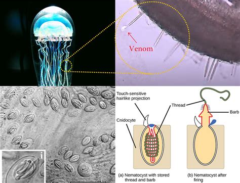 해파리에 쏘였어요