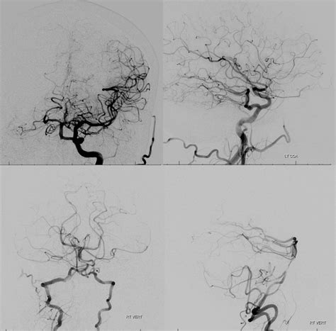 Index Of Wp Content Uploads Trigeminal
