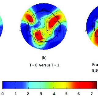 EEG Topography Plots Based On Most Active Electrode Regions Download Scientific Diagram