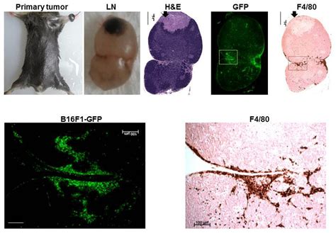 Histopathological Analysis Of A Metastatic Lymph Nodes From A B16f1gfp