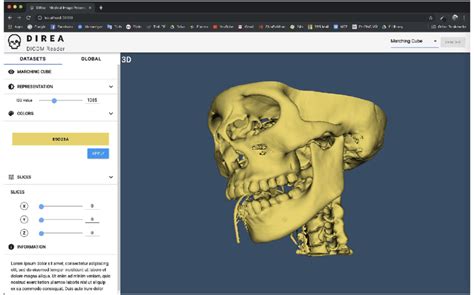 User Interface Of Marching Cube Algorithm Download Scientific Diagram