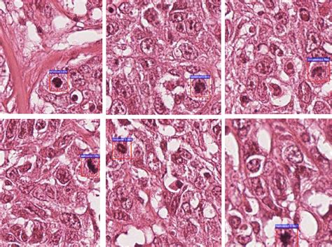 multi stream faster rcnn for mitosis counting in breast cancer images