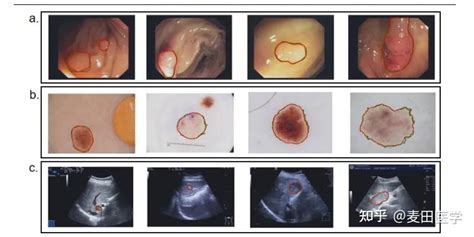 Mtanet 多任务注意力网络，用于自动医学图像分割和分类 文献速递 深度学习结合医疗影像疾病诊断与病灶分割 知乎