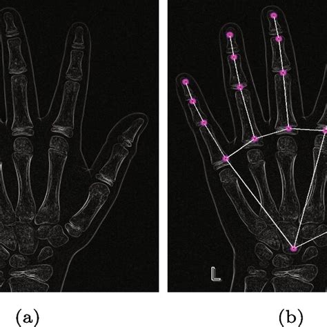 A Edge Map After Applying The Sobel Operator B Hand Topology Map