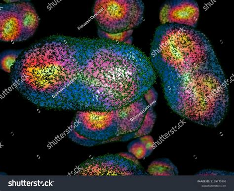 Smallpox Virus Under Microscope There Many Stock Illustration 2159775995 Shutterstock