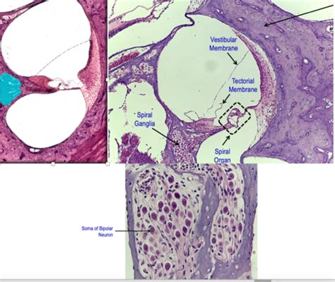 Tectorial Membrane Histology
